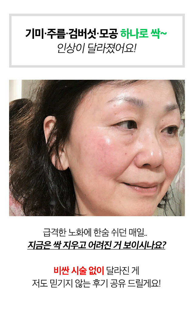  MS 2 PLUS 